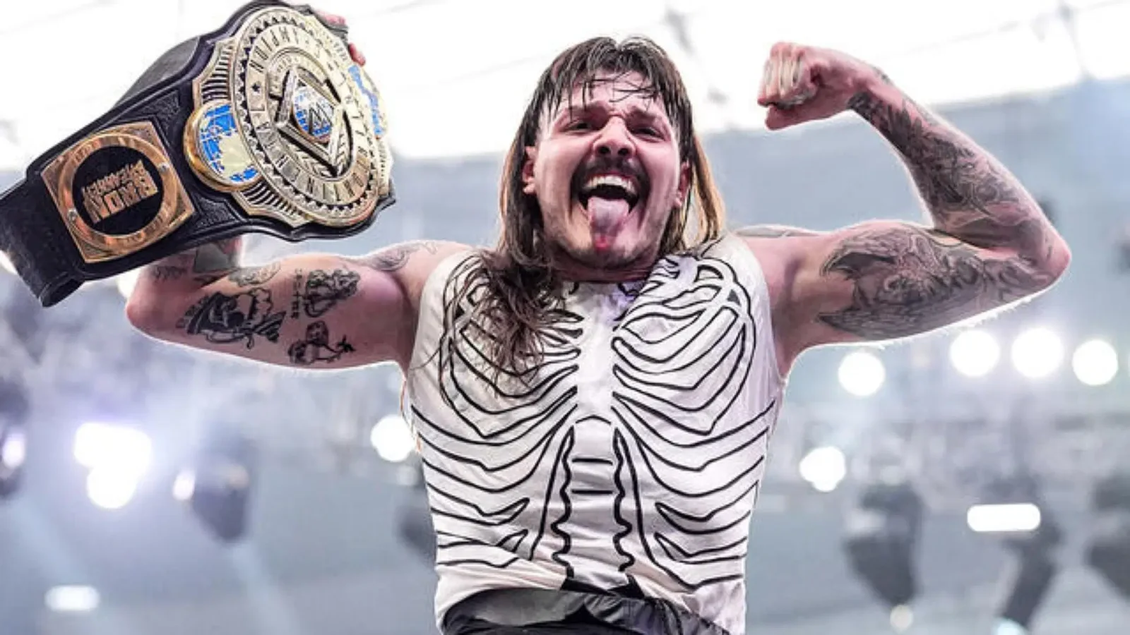 WWE Urged to Reinstate Title Rule After Dominik Mysterio Injury Shakes ...